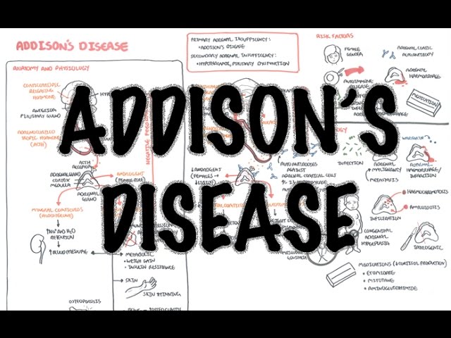 Addison's Disease - (DETAILED) Overview