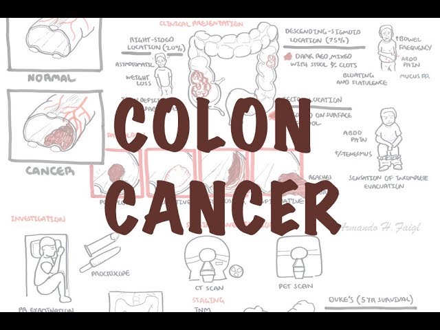 Colorectal Cancer - Overview - 2025