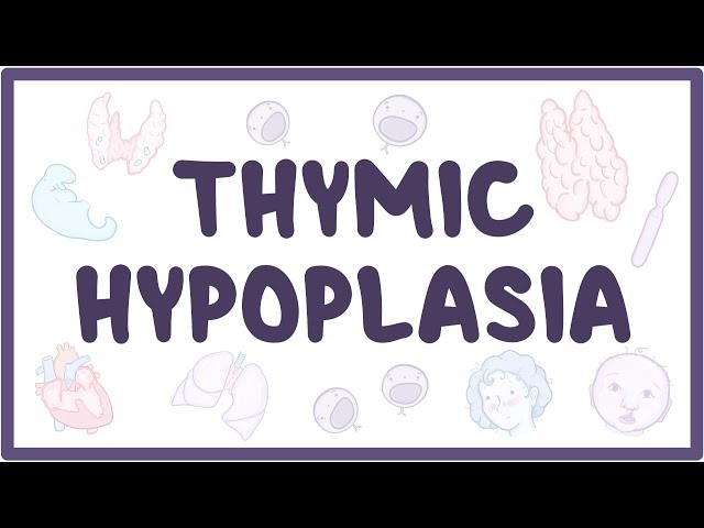 Thymic Hypoplasia - Causes, Symptoms, Diagnosis, Treatment, Pathology ... Thymic Hypoplasia - Causes, Symptoms, Diagnosis, Treatment, Pathology ...